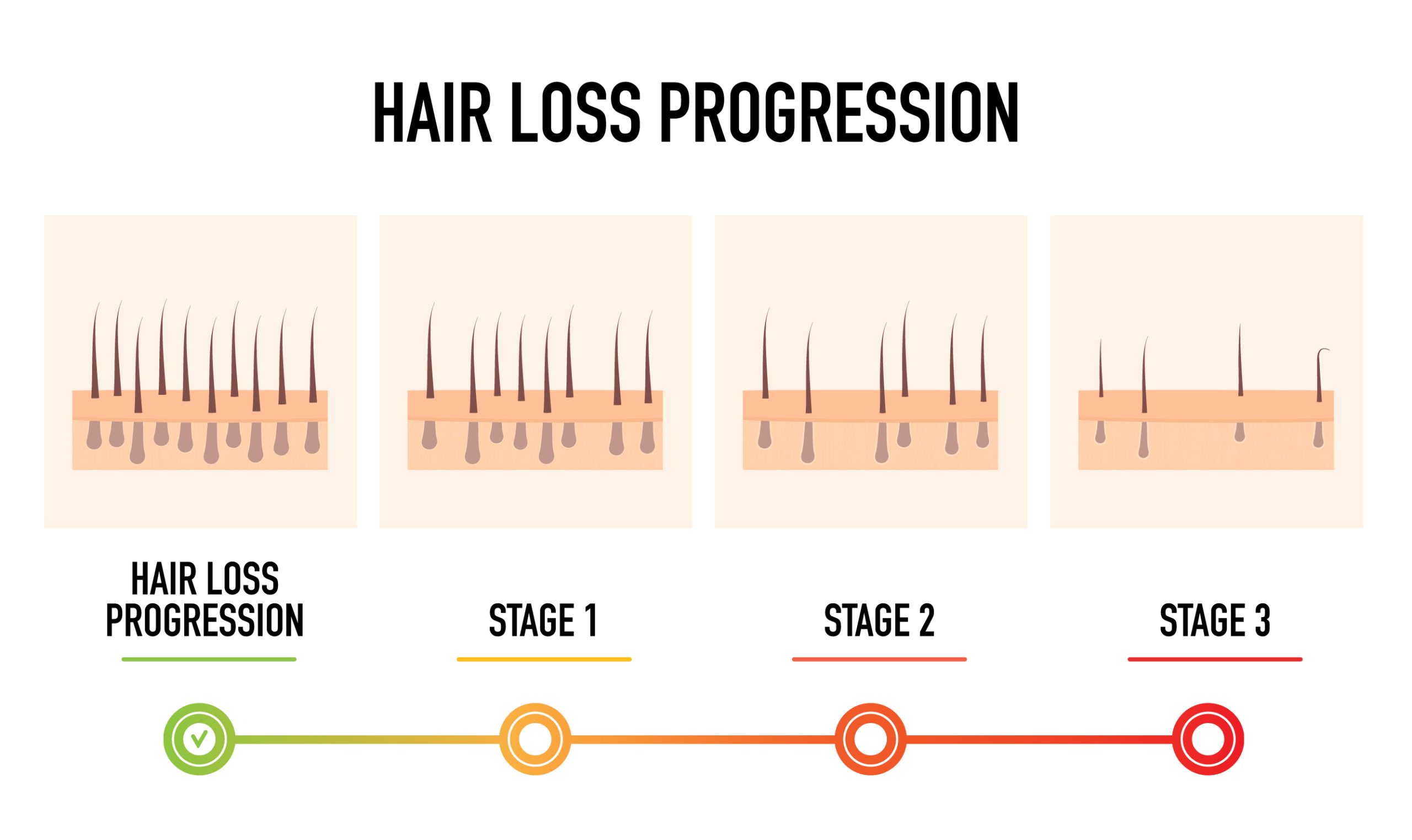 Hair Loss: Causes, Types & Treatment